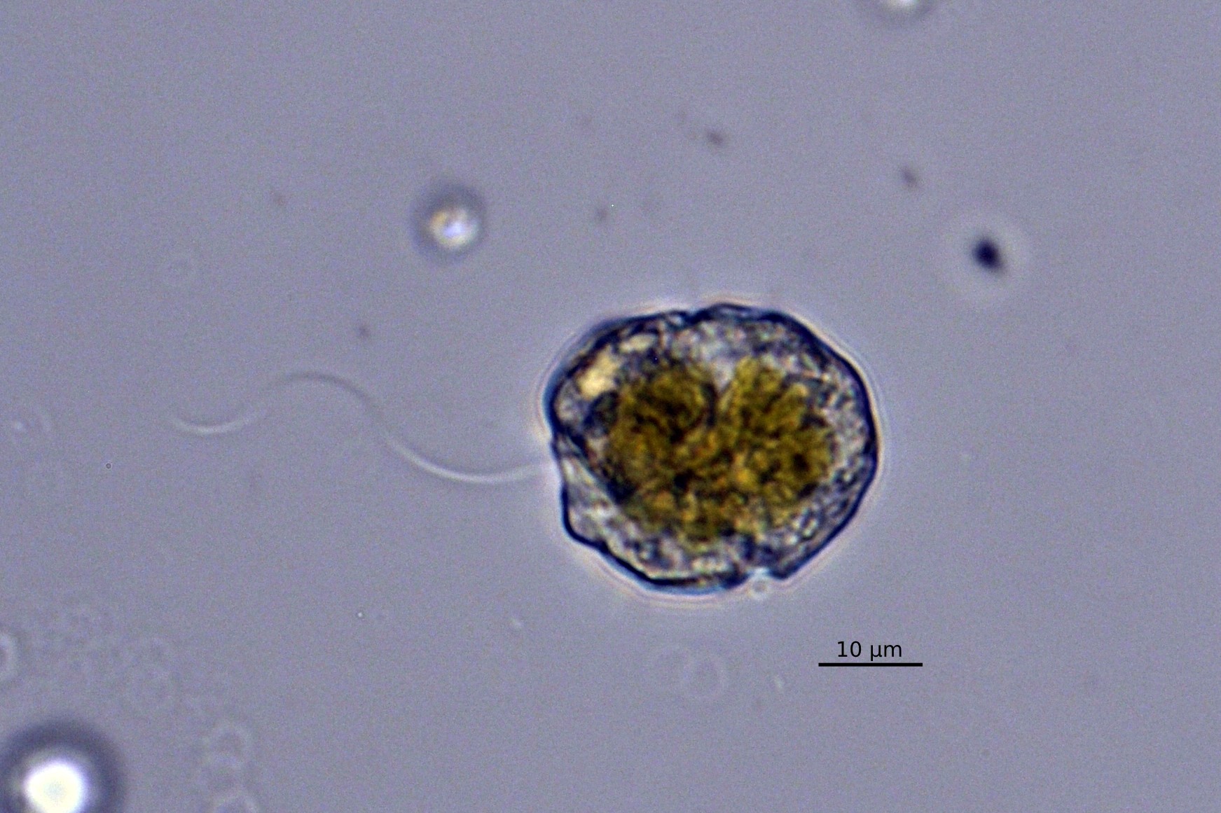 Fat plankton cells - Centre for Ocean Life